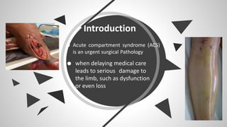 Dermatotraction- Novel surgical wound closures methods - dr. ali barat.pptx