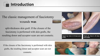 Dermatotraction- Novel surgical wound closures methods - dr. ali barat.pptx
