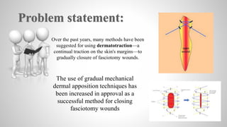 Dermatotraction- Novel surgical wound closures methods - dr. ali barat.pptx