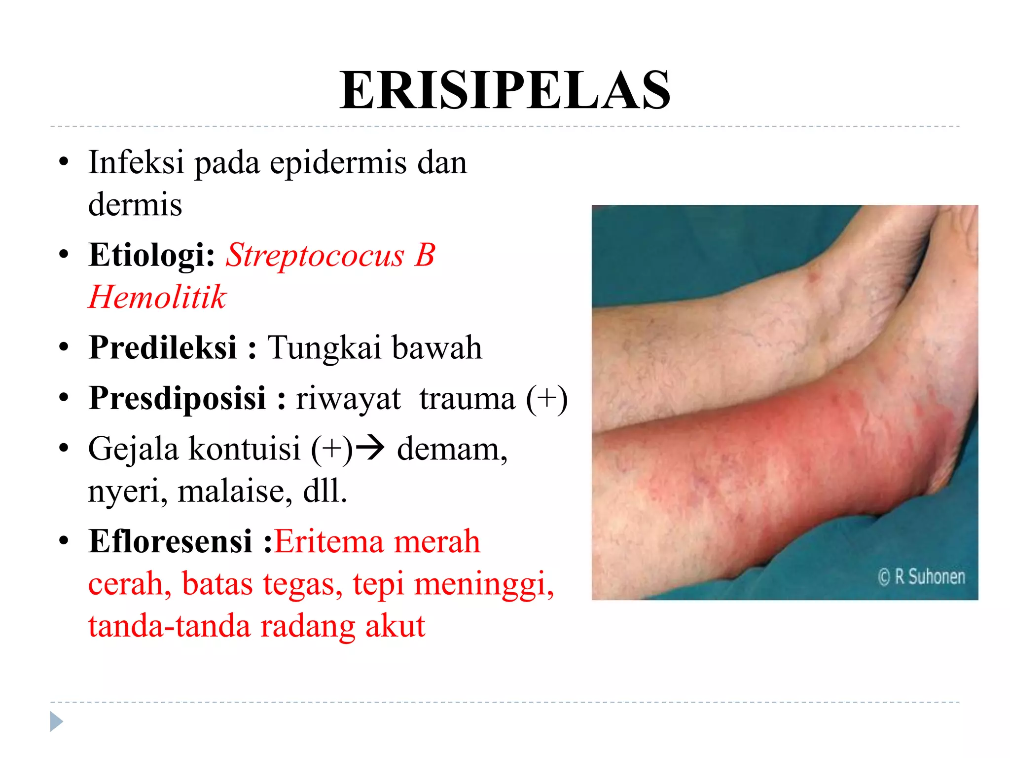 DERMATOVENEROLOGI.pdf