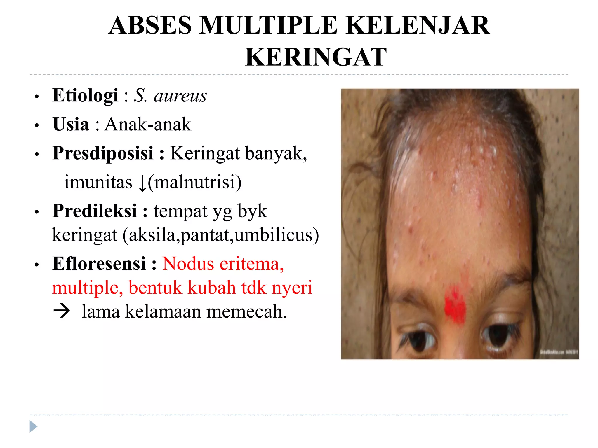 DERMATOVENEROLOGI.pdf