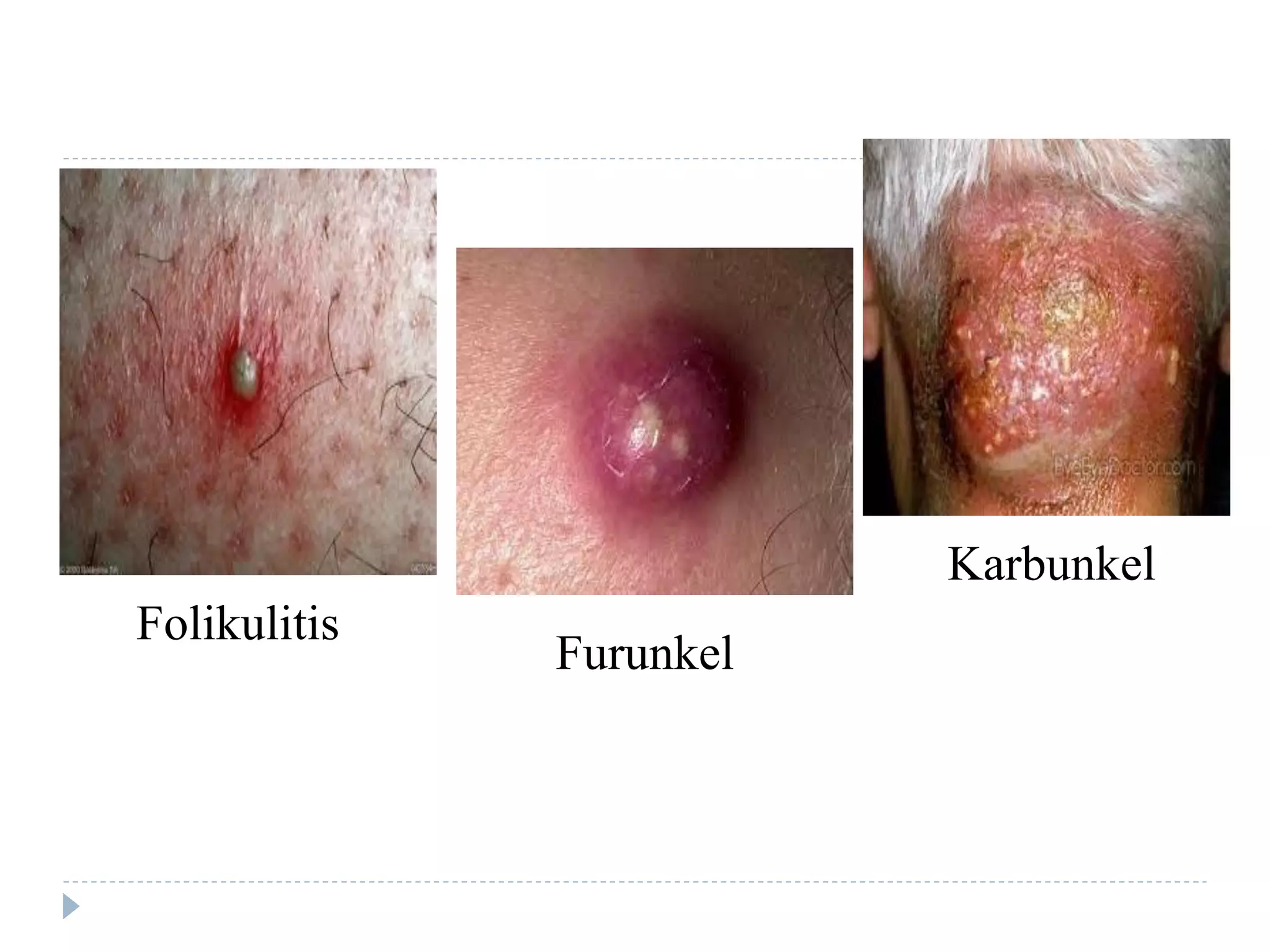 DERMATOVENEROLOGI.pdf