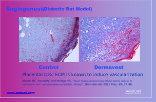 Dermavest overview | PPT