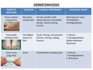 Dermetomycosis & measles | PPT