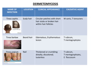 Dermetomycosis & measles | PPT