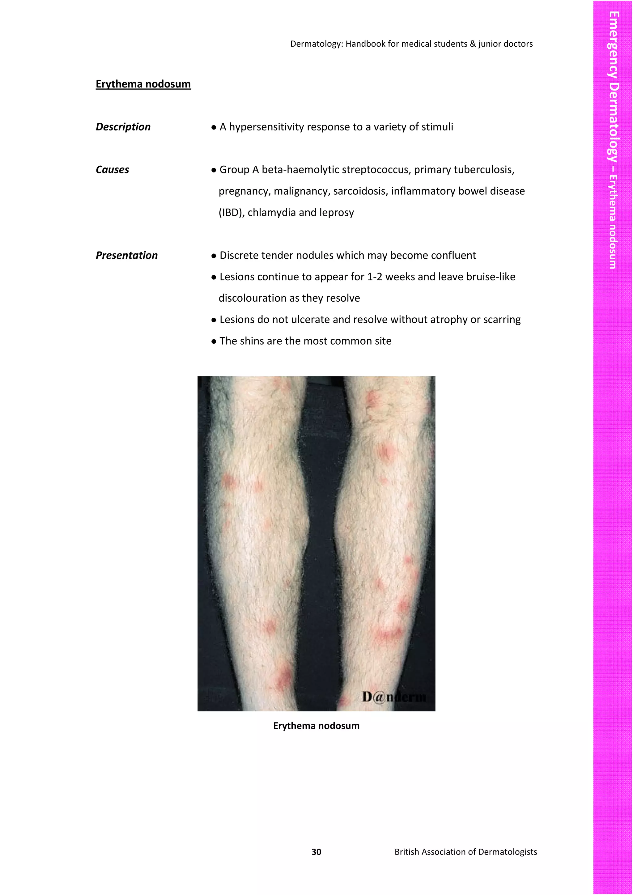 Derm handbook for medical students and junior doctors 2010 | PDF