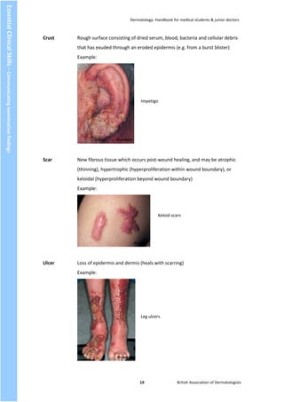 Derm handbook for medical students and junior doctors 2010 | PDF
