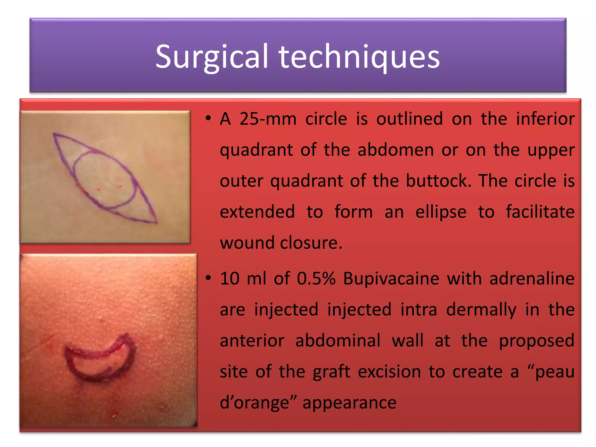 Dermis fat grafts | PPTX