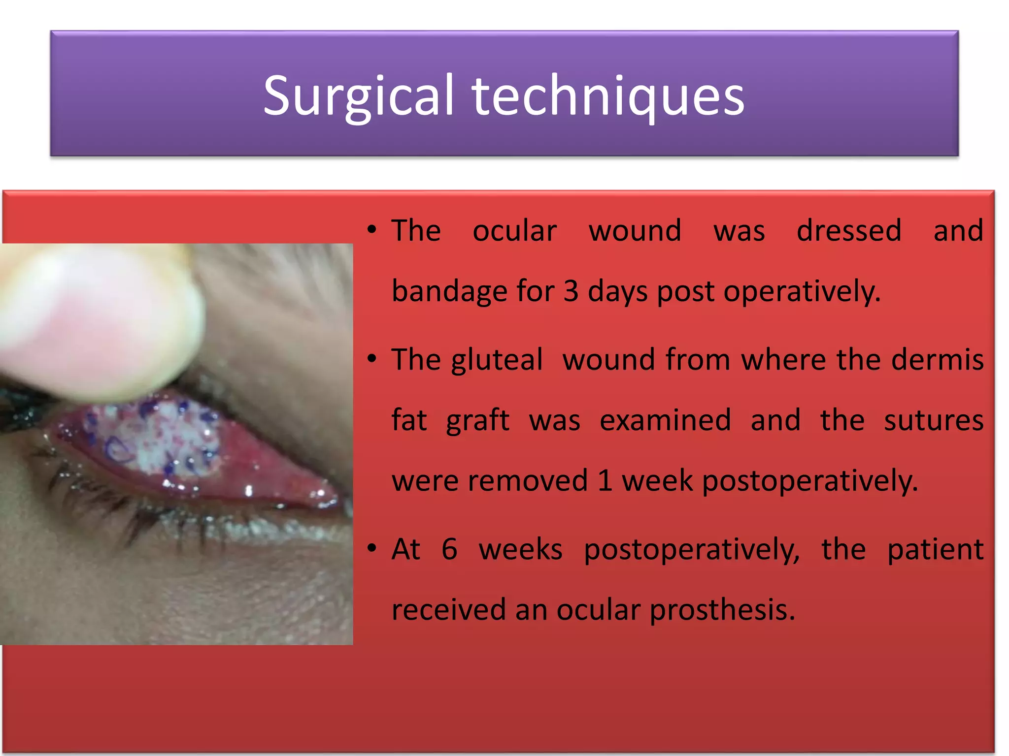 Dermis fat grafts | PPTX