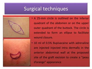 Dermis fat grafts | PPT