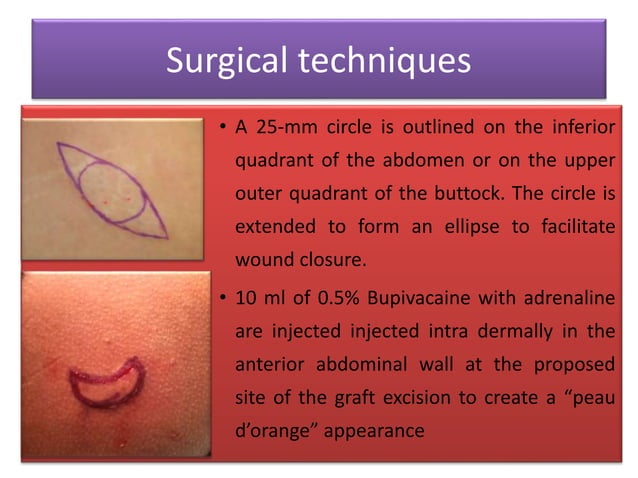 Dermis fat grafts | PPT