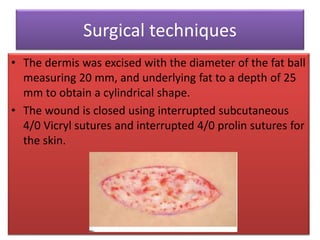 Dermis fat grafts | PPT