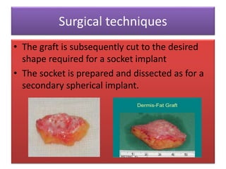 Dermis fat grafts | PPT