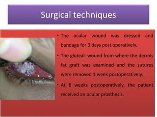 Dermis fat grafts | PPT