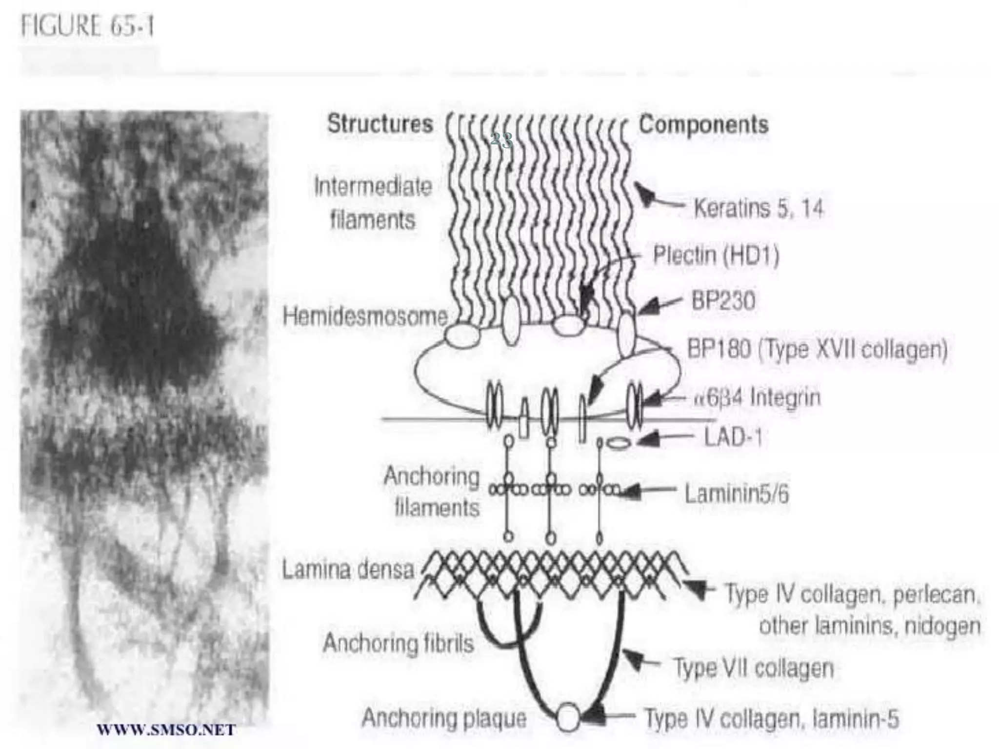 Dermo epidermal junction | PPTX