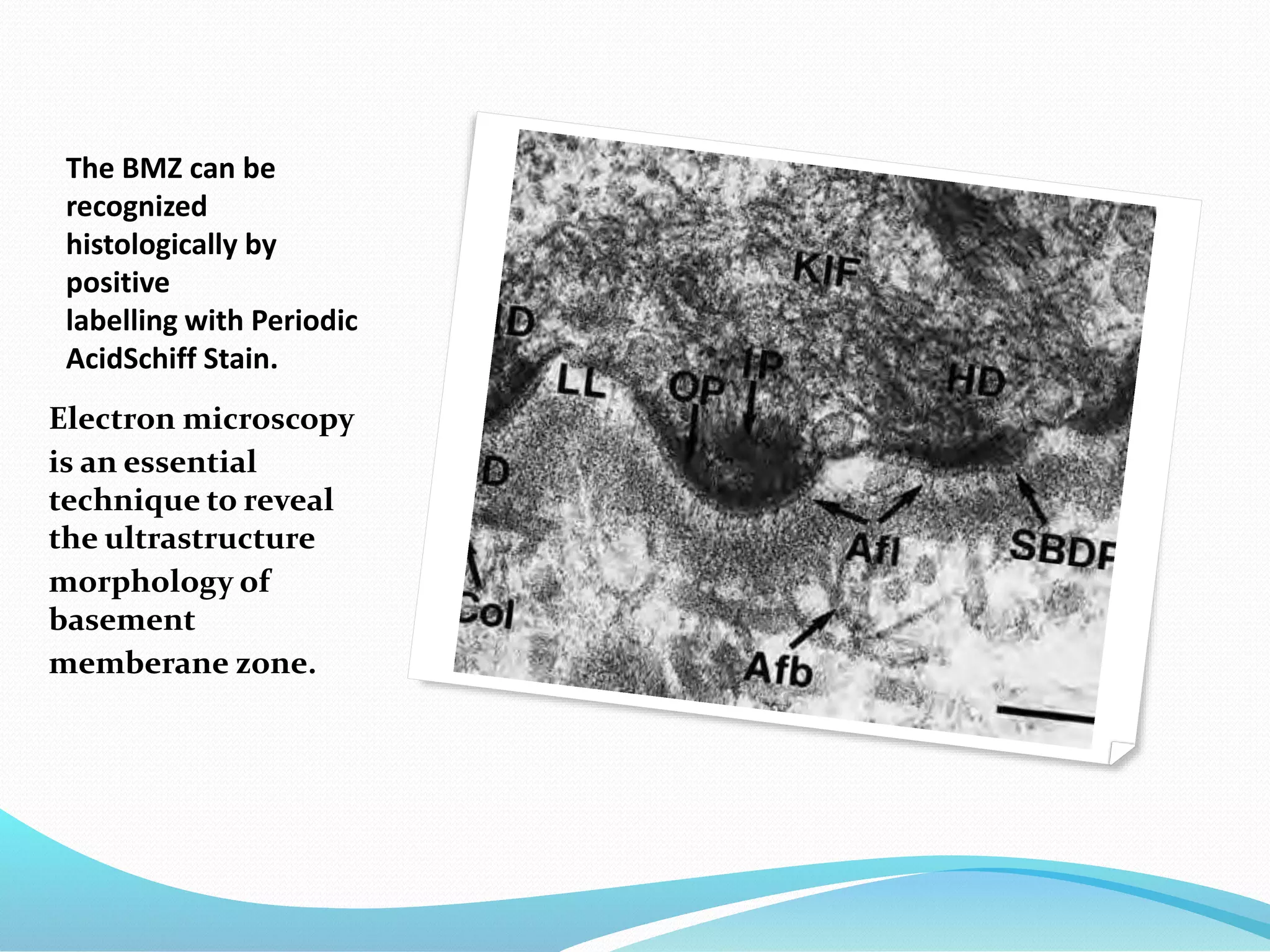 Dermo epidermal junction | PPTX