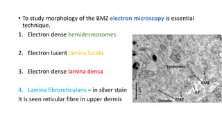 DERMO EPIDERMAL JUNCTION ( DEJ ) | PPTX