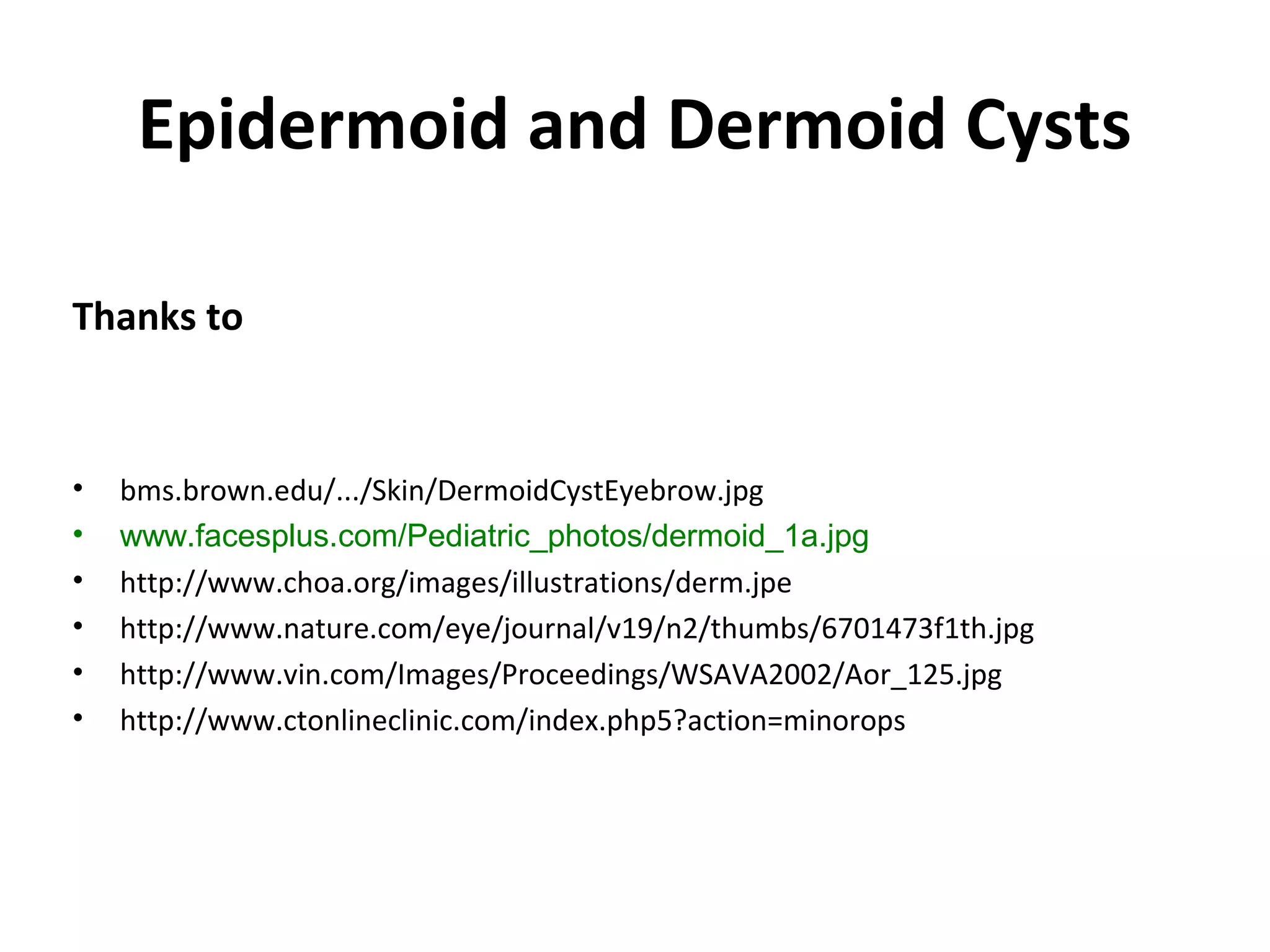 Dermoid & Epidermoid Cysts | PPT