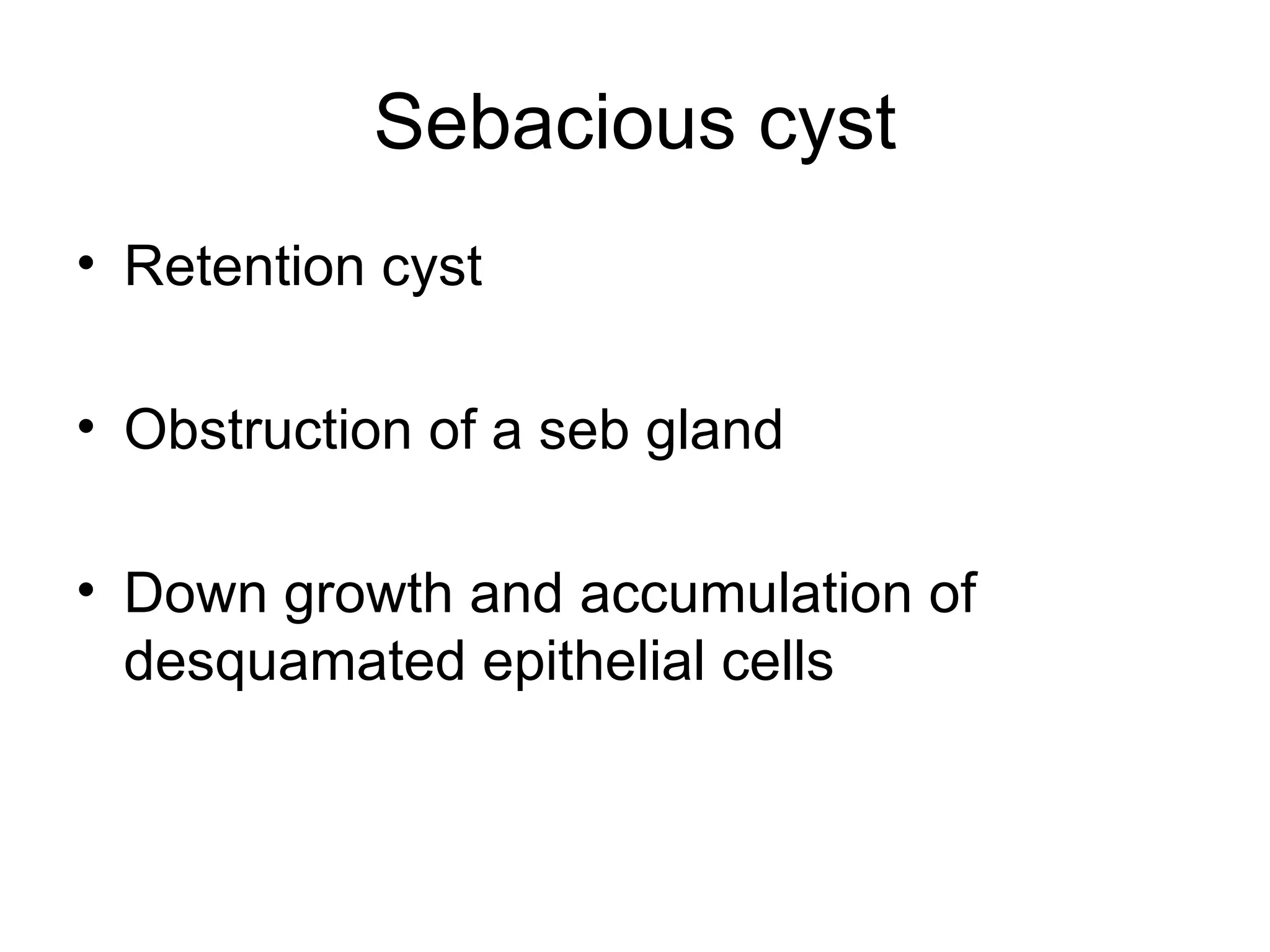 Dermoid Cyst | PPT