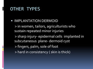 Dermoid cyst | PPTX