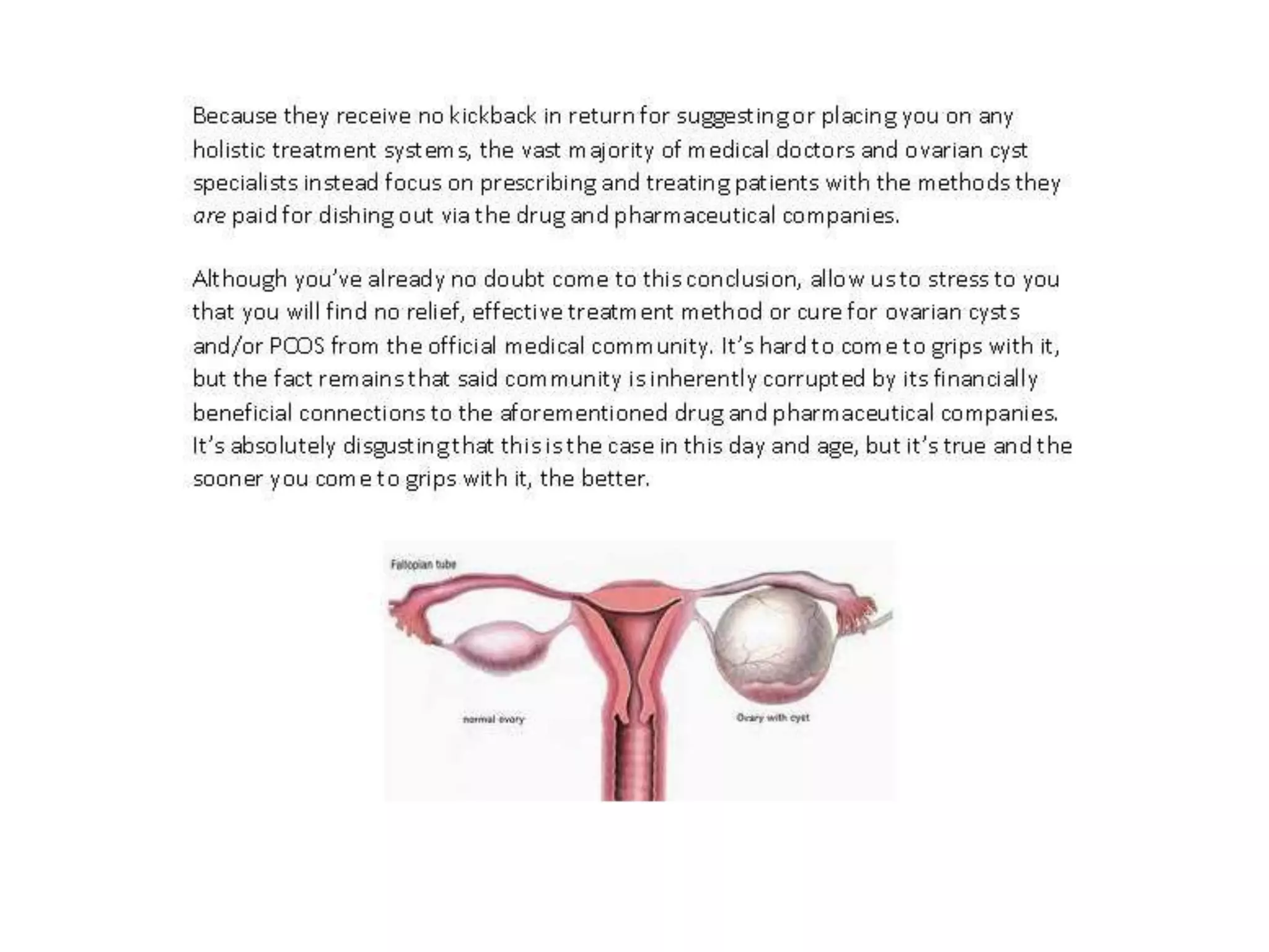 Dermoid Ovarian Cyst Ppt 0809