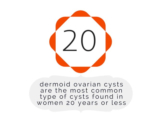 Dermoid Ovarian Cysts By The Numbers - Things You Should Know | PDF
