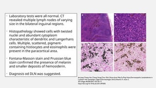 Dermopathic lymphadenopathy- causes and evaluation | PPTX