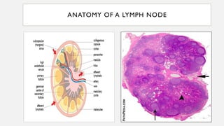 Dermopathic lymphadenopathy- causes and evaluation | PPTX