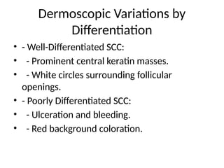 Dermoscopic_Findings_in_SCuriririrC.pptx