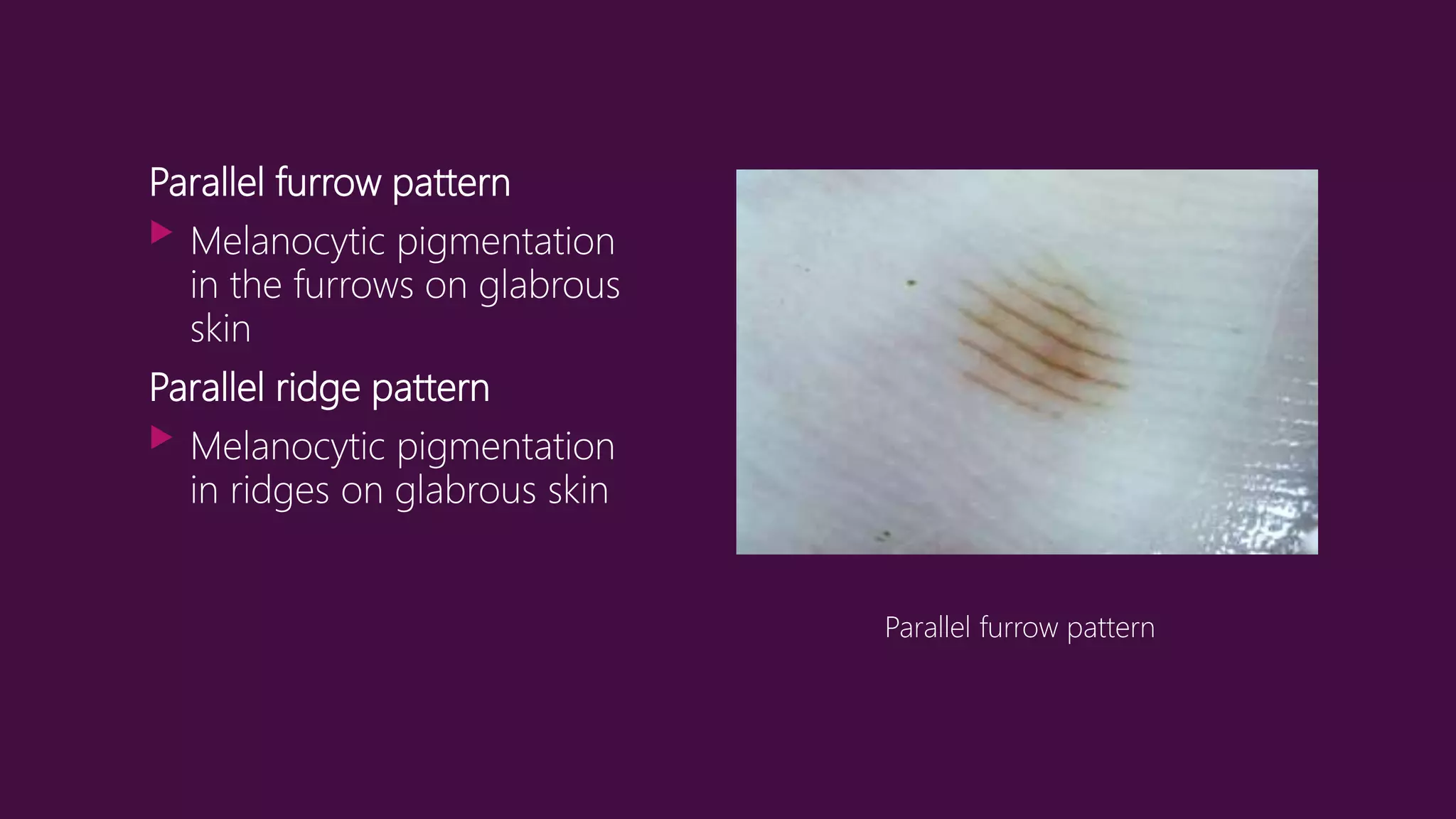 Dermoscopy an overview | PPTX