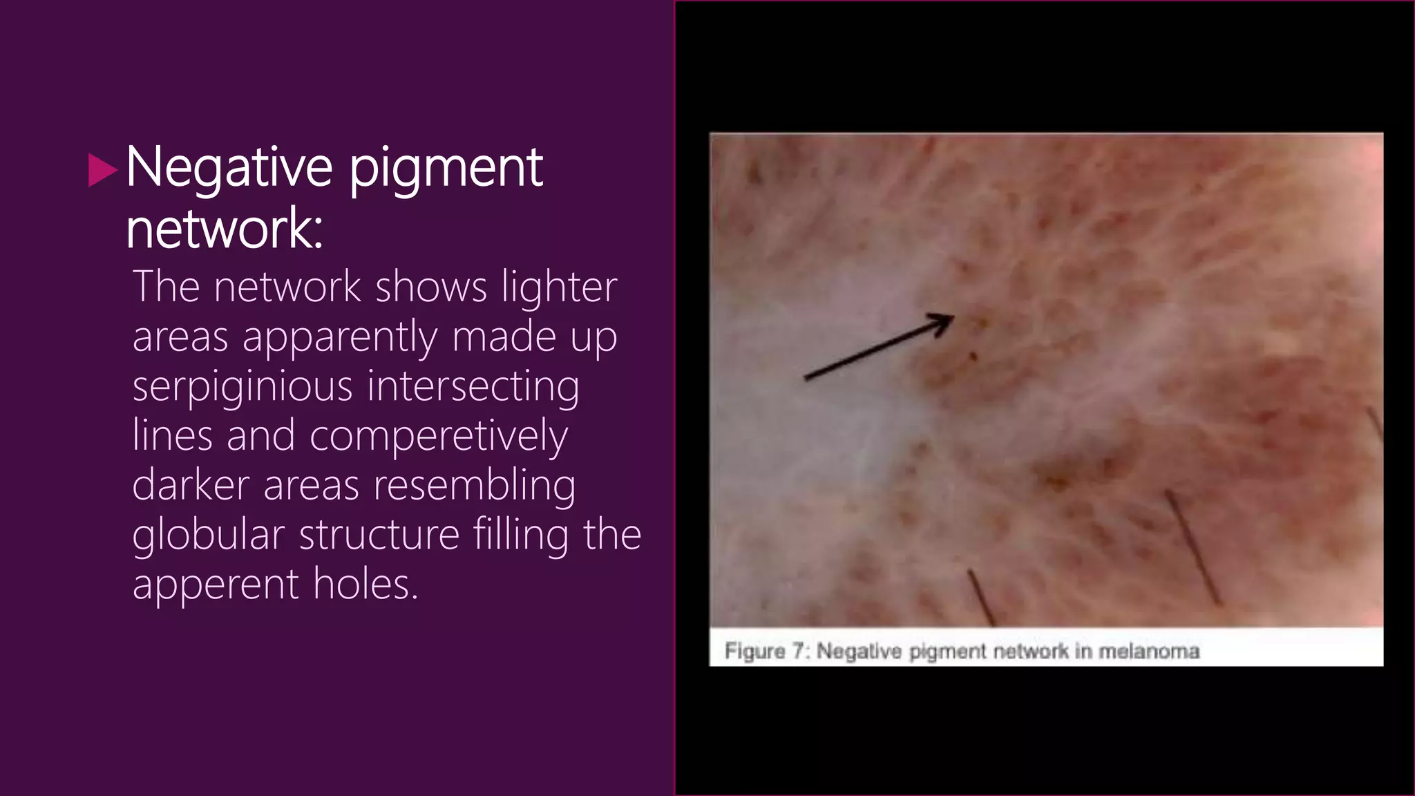 Dermoscopy an overview | PPTX