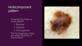 Dermoscopy an overview | PPTX