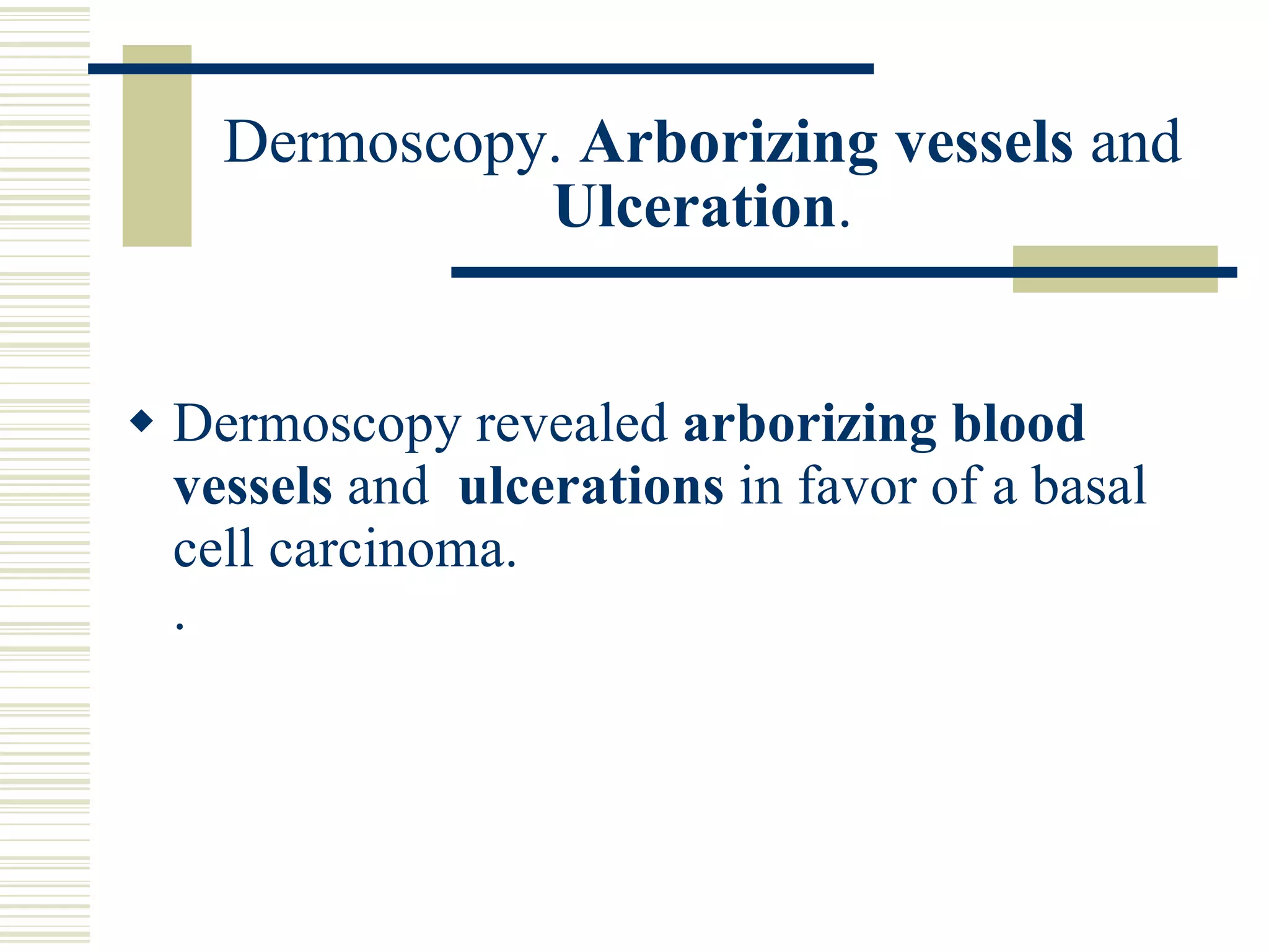 Dermoscopy Arborizing Vessels And Ulceration | PPT