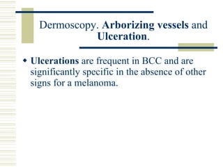 Dermoscopy Arborizing Vessels And Ulceration | PPT