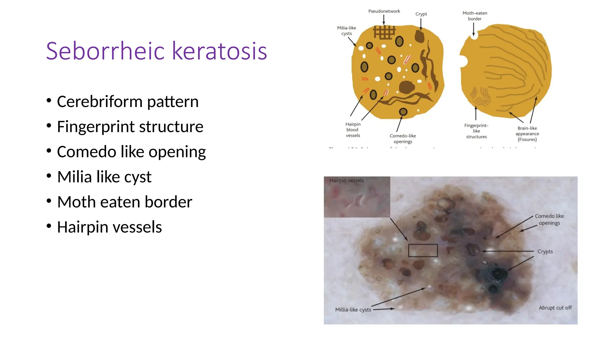 Dermoscopy in various skin disorders.pptx
