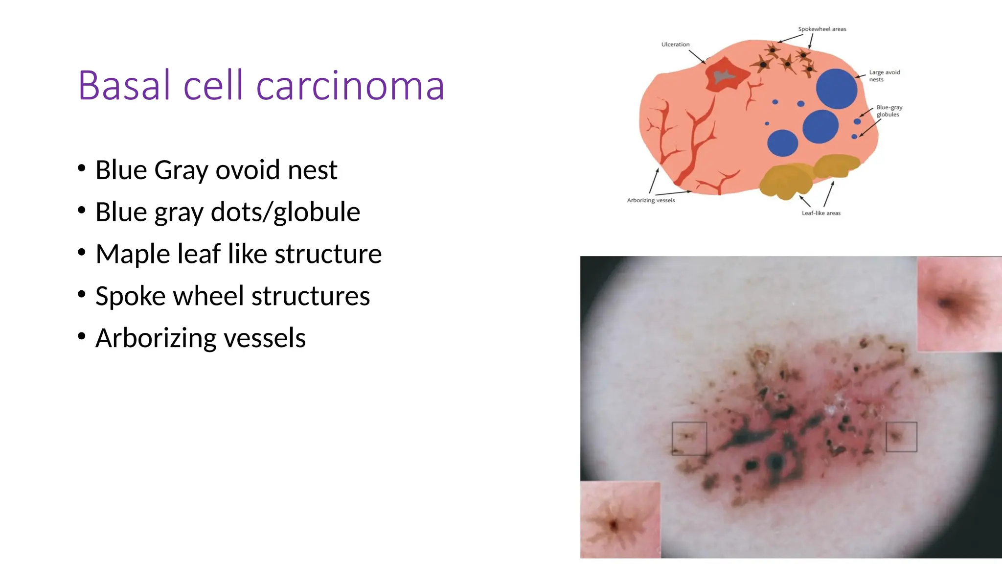Dermoscopy in various skin disorders.pptx