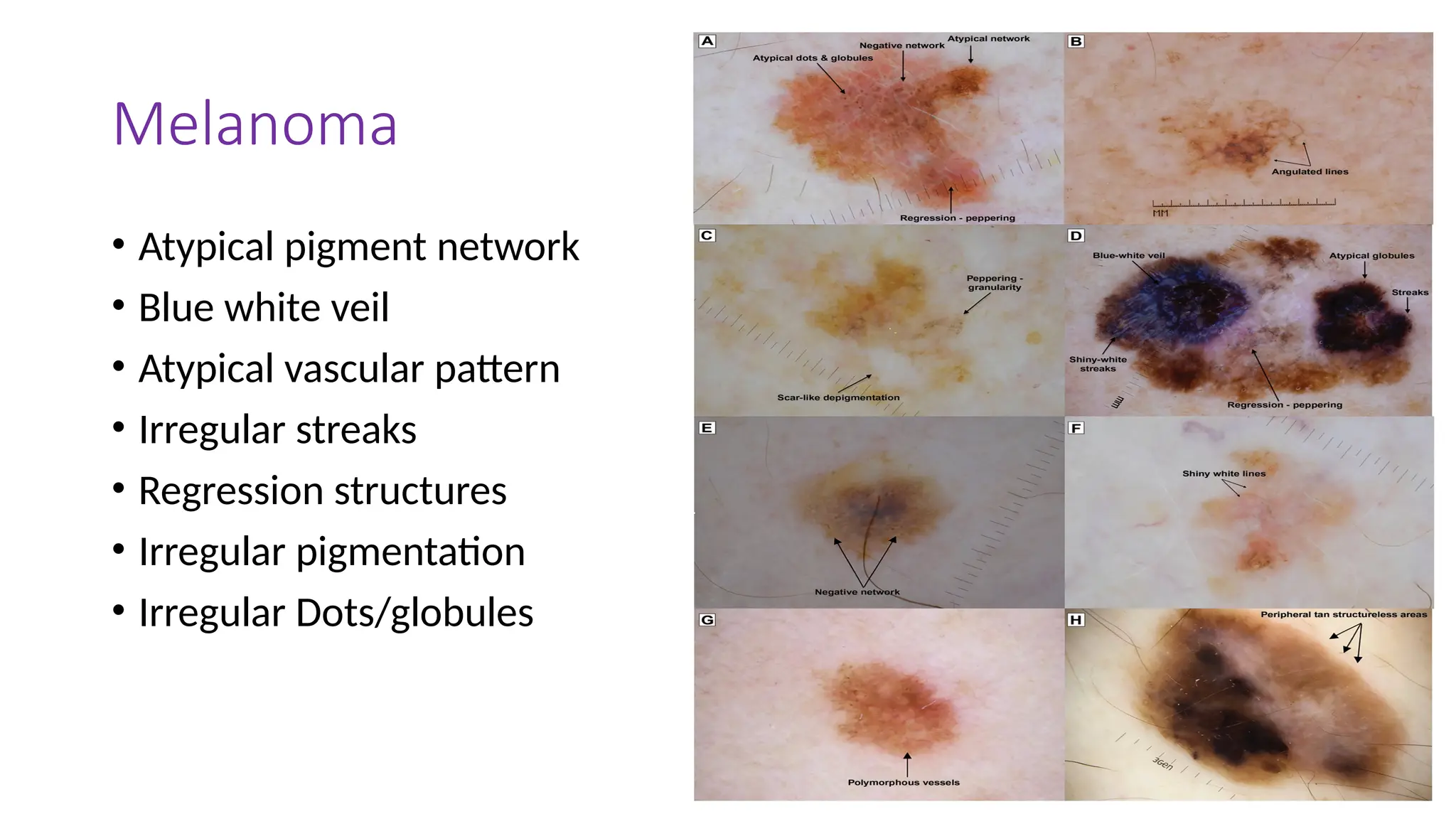 Dermoscopy in various skin disorders.pptx