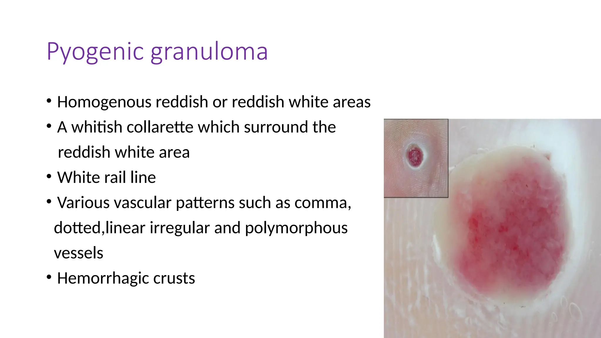 Dermoscopy in various skin disorders.pptx