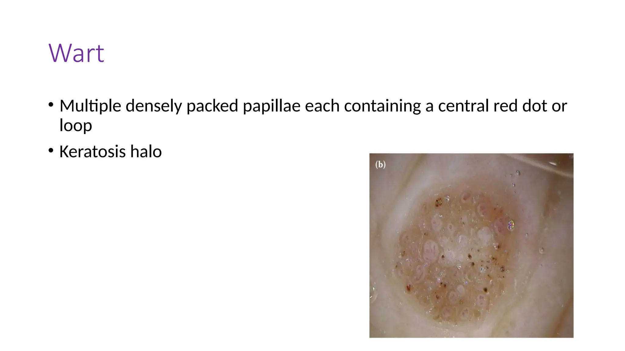 Dermoscopy in various skin disorders.pptx