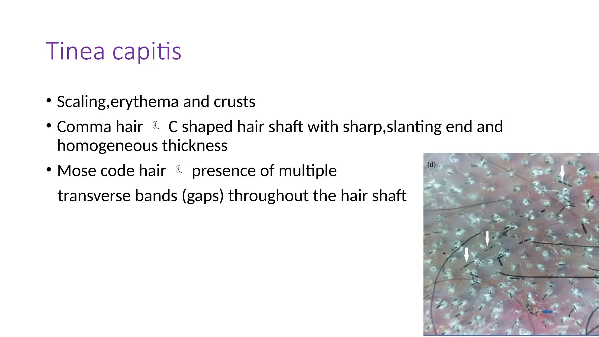 Dermoscopy in various skin disorders.pptx