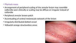 Dermoscopy in various skin disorders.pptx