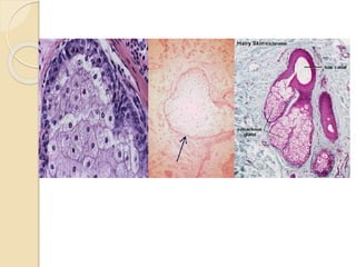 Dermpath surgical pathology | PPTX