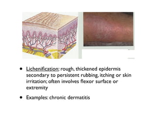 Derm slides | KEY