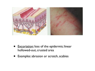 Derm slides | PPT