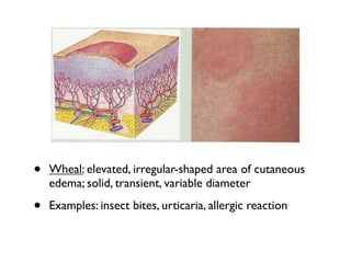 Derm slides | KEY | Skin and Dermatology | Diseases and Conditions