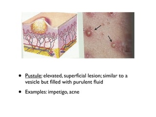 Derm slides | KEY | Skin and Dermatology | Diseases and Conditions