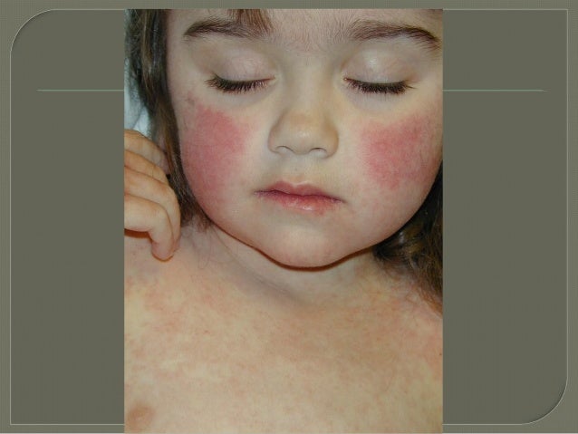 Pediatrics Jeopardy Template