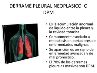 DERRAME-PLEURAL-MALIGNOsmskskskksksksk.pptx