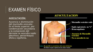 semiologia Derrame pericárdico y derrame Pleural | PPTX