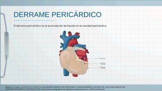 Derrame Pericardico, clase 1 de cardiologia internado | PDF